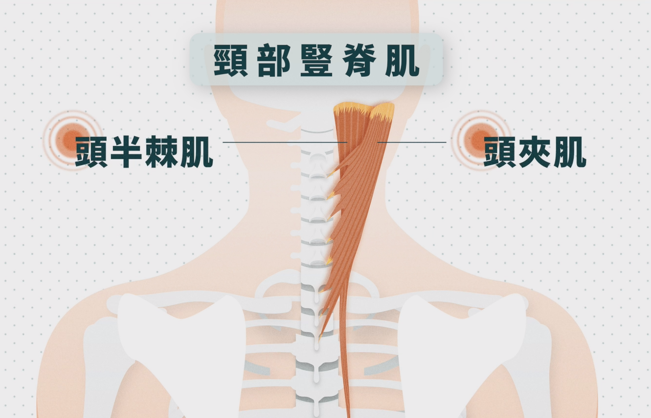 長期偏頭痛無法解？原來是頸因性頭痛！｜SunGuts 三個字物理治療所